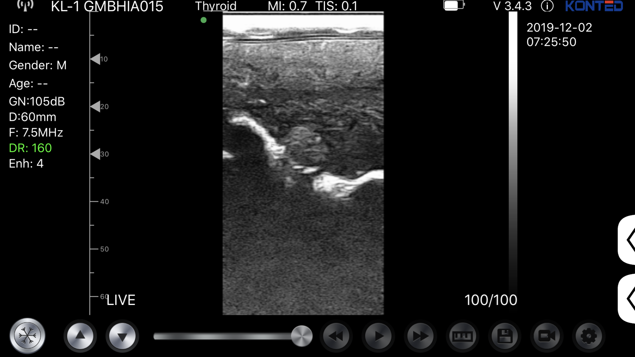 PENG Block Trainer – ecoicatech 2022