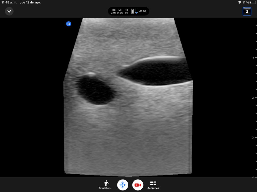 CENTRAL LINE Trainer™ – ecoicatech 2022