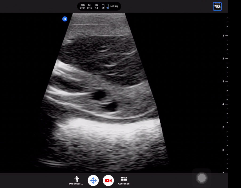iPACK Block Trainer module – Ecoicatech